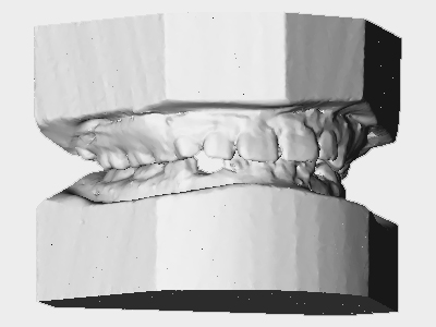 Ortho Cast Study Models, LLC - Orthodontic Study Models Dental Digital ...